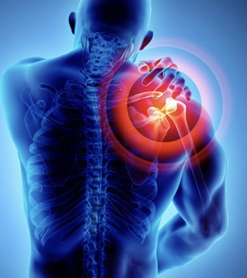 Simple Shoulder Test (SST) - NeuroXtrain